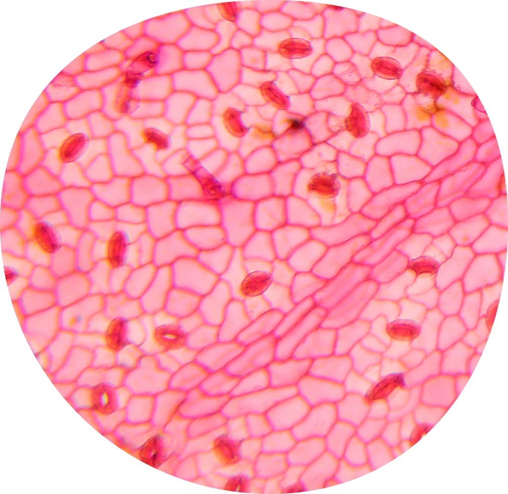 Normocytic normochromic anemia
